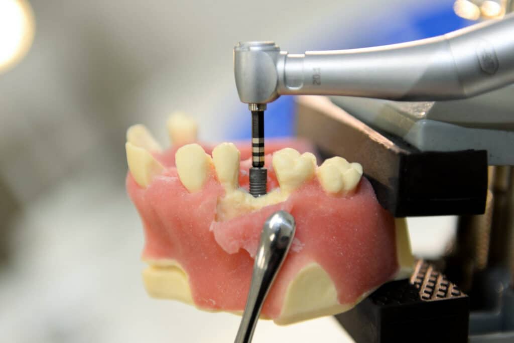 Dental Implant Training Courses & CE | Misch Implant Institute