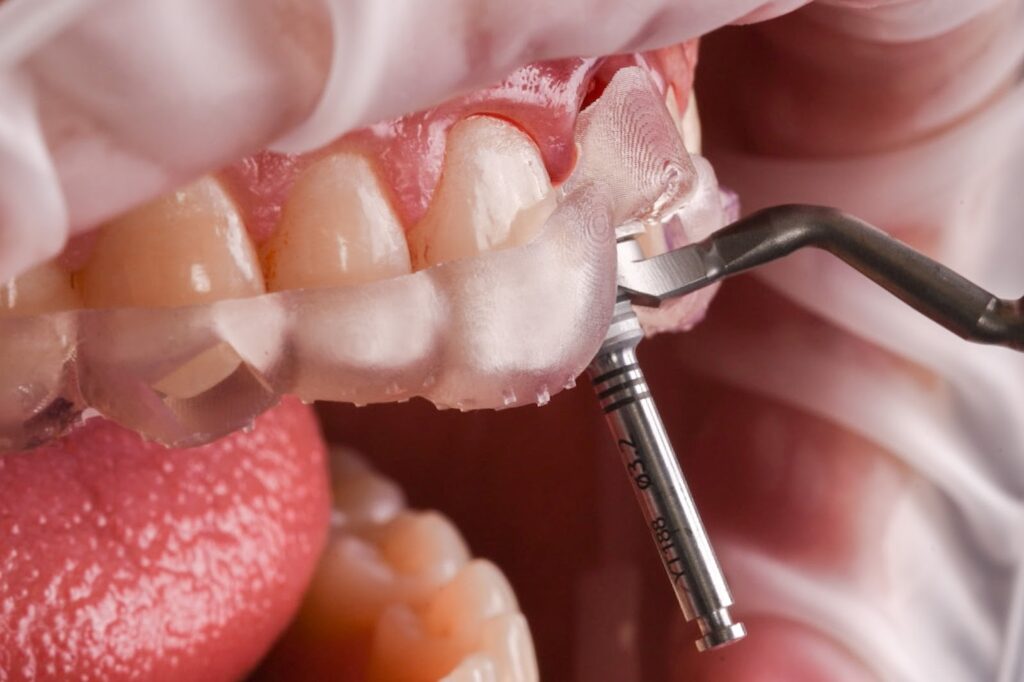 Dental Implant Training Courses & CE | Misch Implant Institute